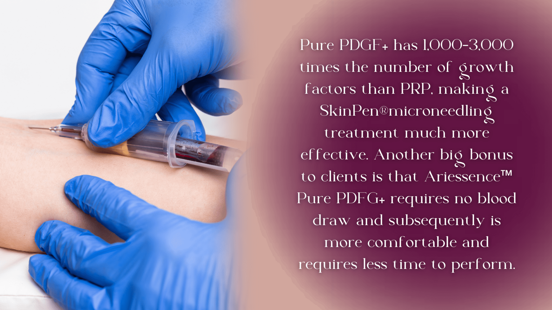 Ariessence™ Pure PDGF+ VS Platelet-Rich Plasma (PRP) - What's the Difference? - The Refinery ...