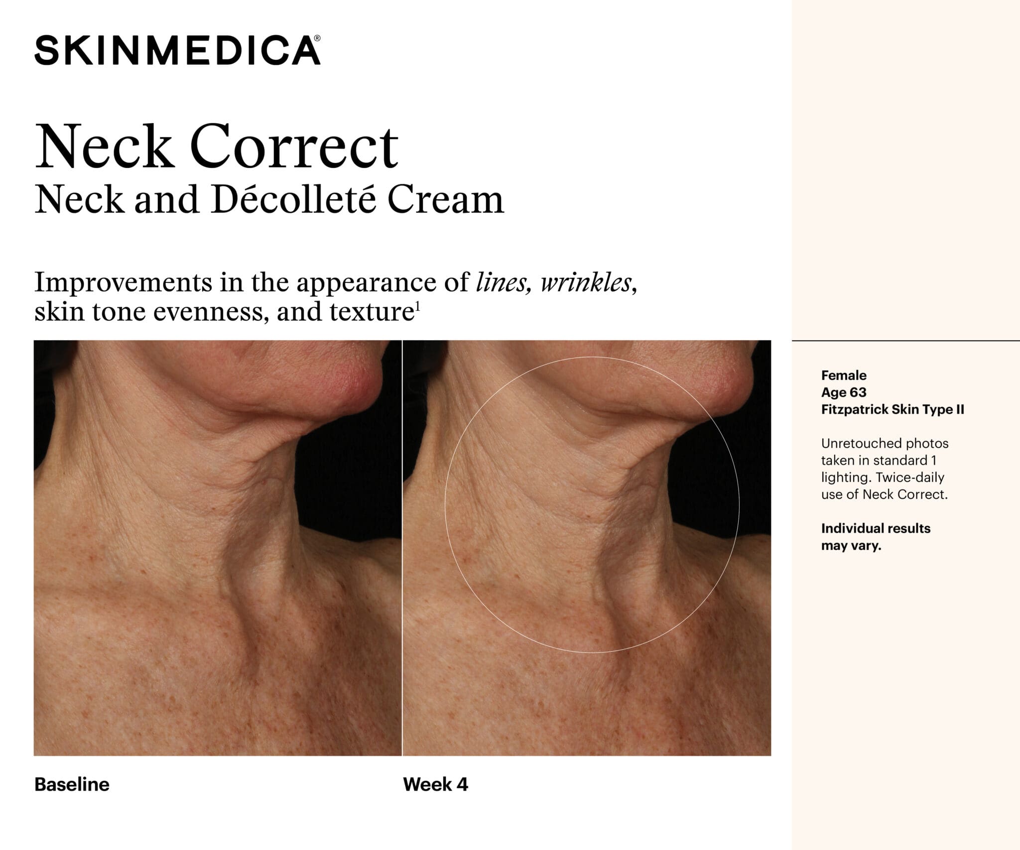 Loose Skin After Weight Loss? 6 Non-Surgical Solutions That Improve ...